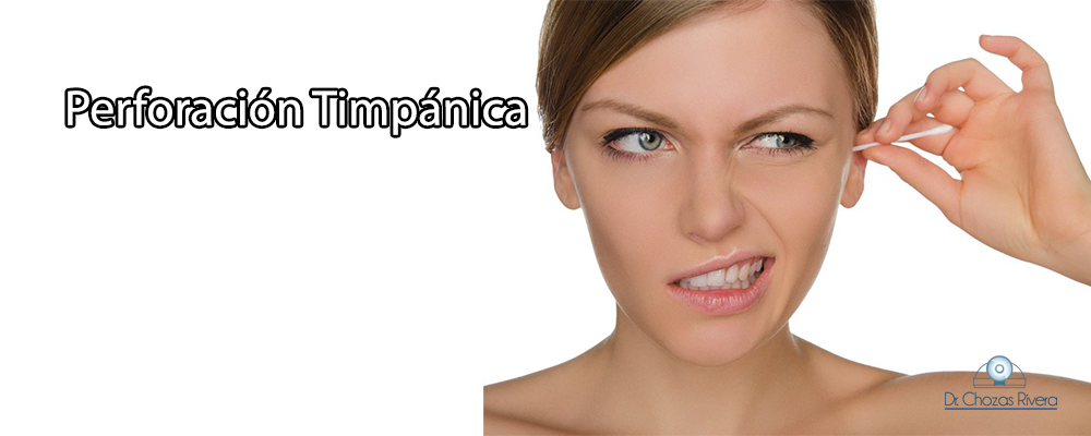 Perforación Timpánica | Dr. Chozas Rivera